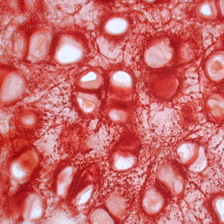 Celledeling ved mitose - undervisningsmateriale til biologi